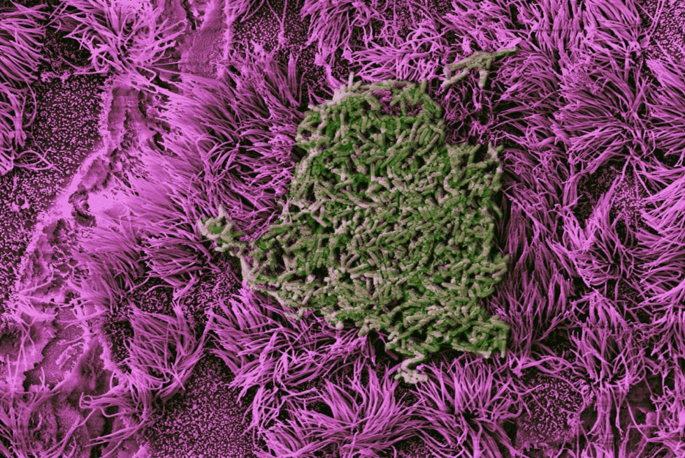 What are biofilms? - NBIC