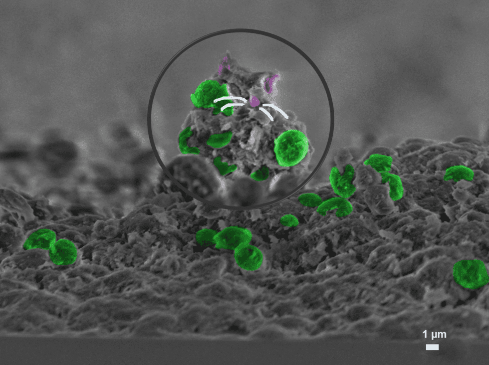 Biofilm Image Gallery - NBIC