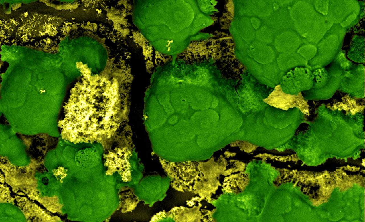 Biofilm Image Gallery - NBIC